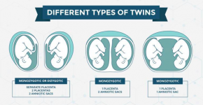 TYPES OF TWINS – Dr.V.GEETHA